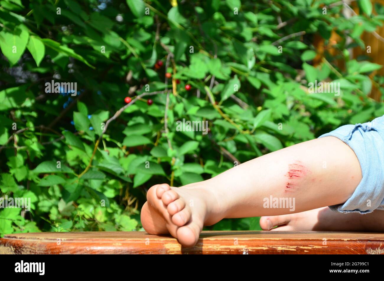 Boy graze knee hi-res stock photography and images - Alamy