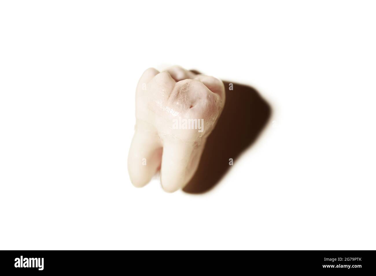 Wisdom tooth with tooth decay, isolated white background. Removed third ...