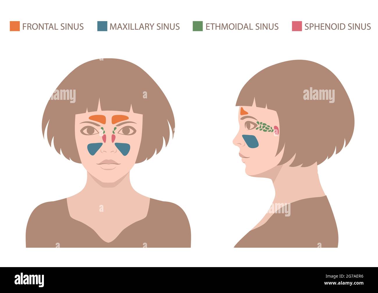 sinusitis disease, vector nose illustration, sinus anatomy, human ...
