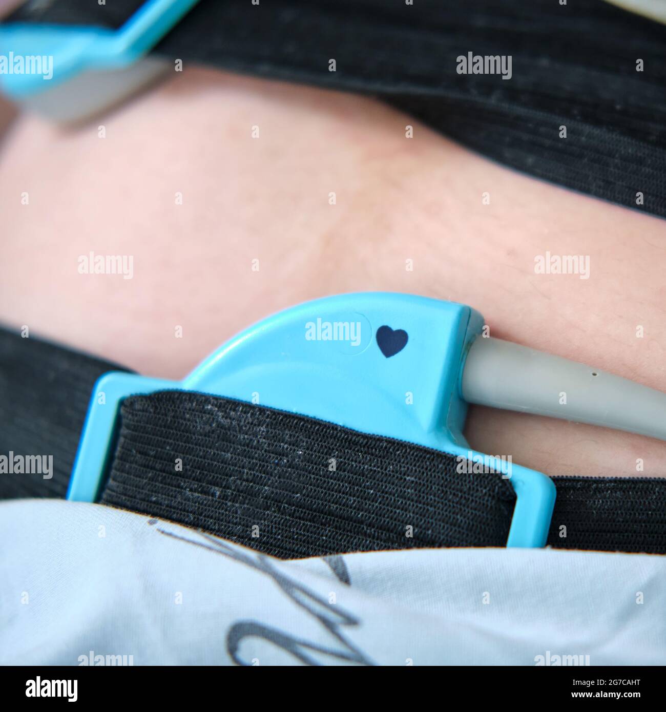 A pregnant woman gives birth in a hospital with a drip and a CTG ...