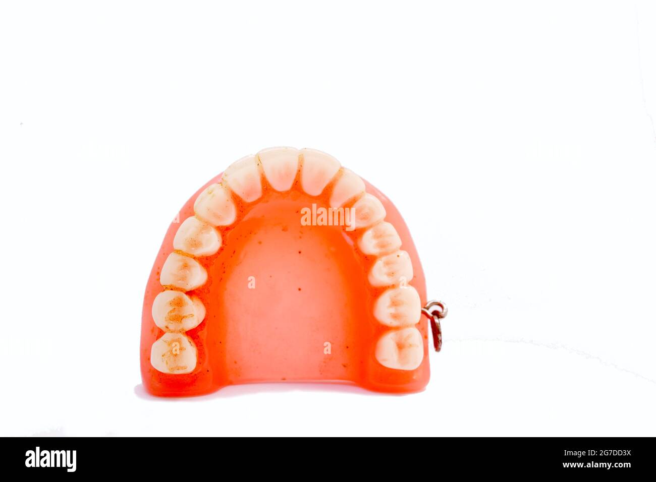 dental prothesis model isolated on white background Stock Photo - Alamy