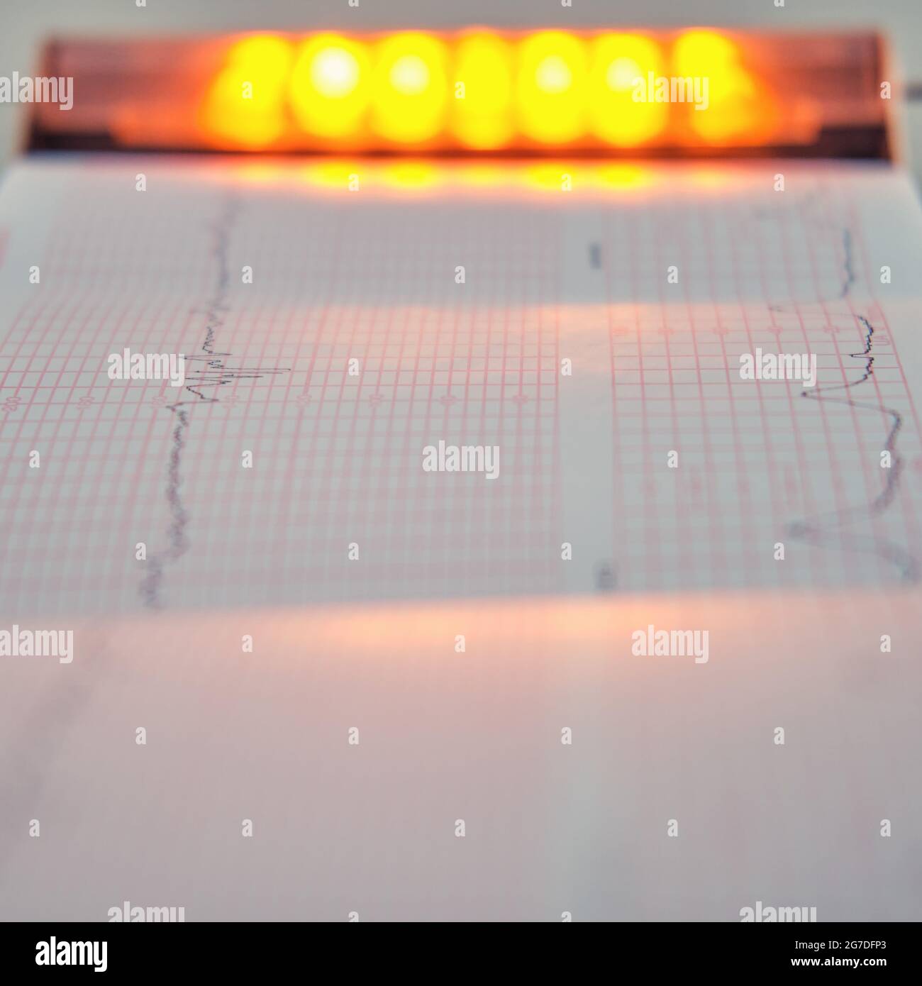 CTG device with monitoring of the state of health of the mother and ...