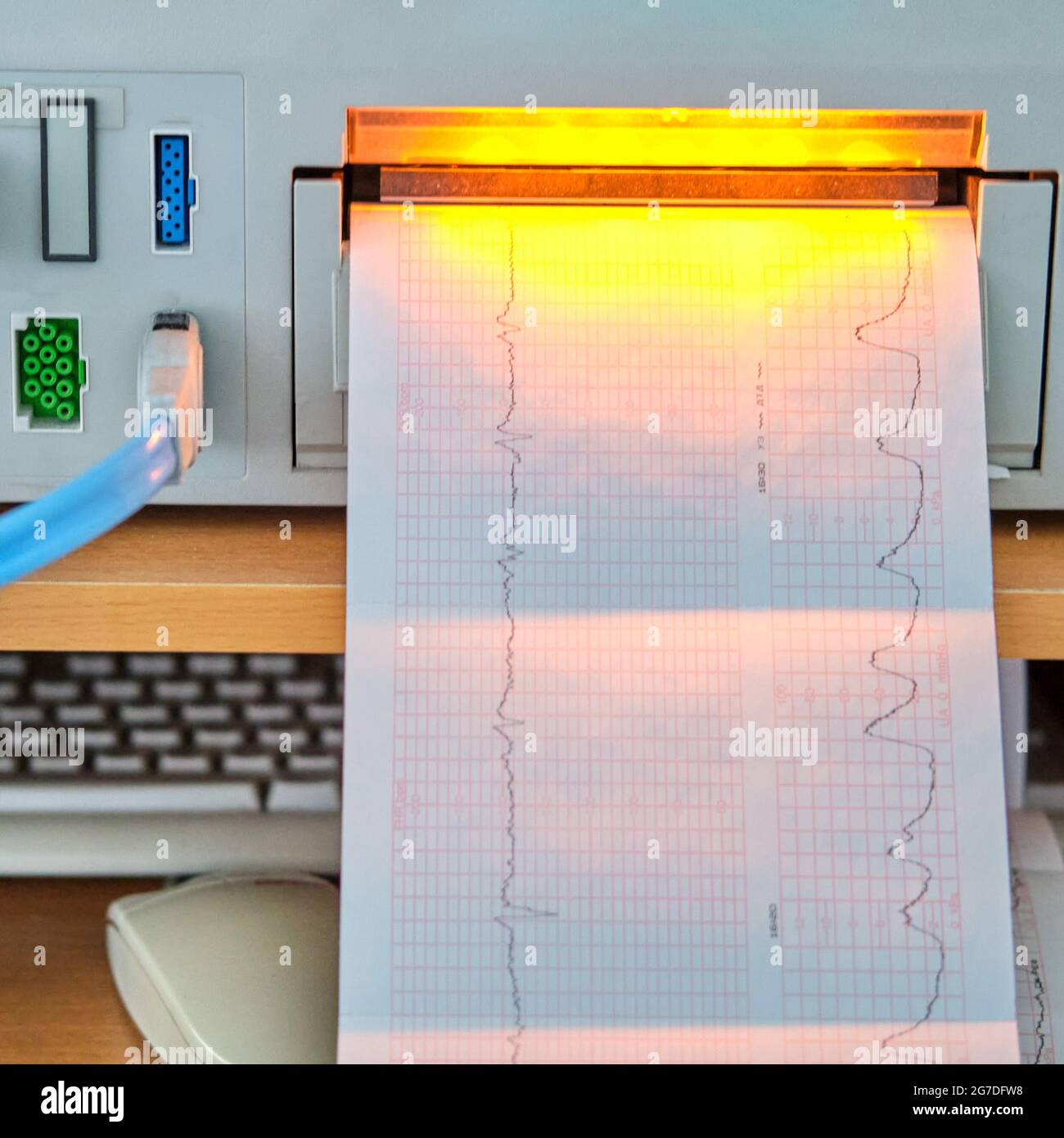 CTG device with monitoring of the state of health of the mother and ...