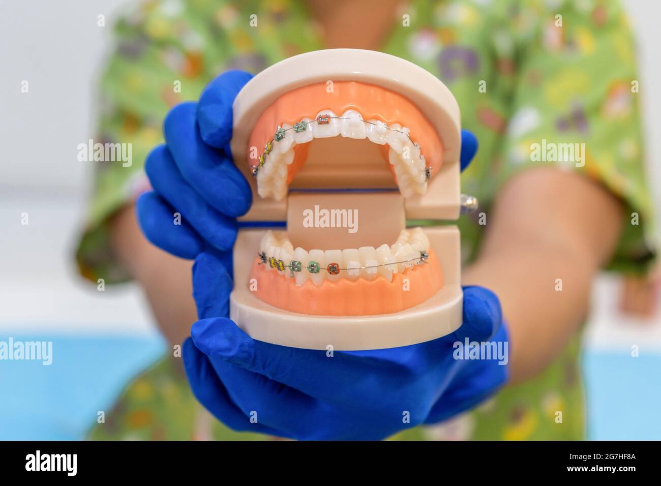 Orthodontic brackets hi-res stock photography and images - Alamy
