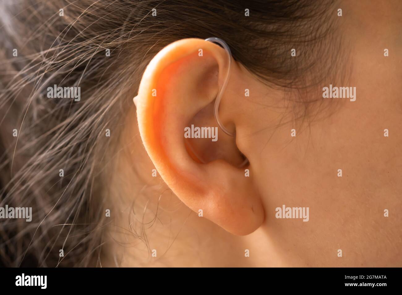 Hearing Aid Deaf Ear Audiology For Handicapped Stock Photo - Alamy