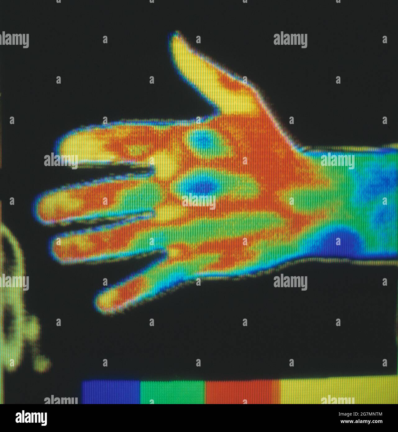 Thermograph hi-res stock photography and images - Alamy