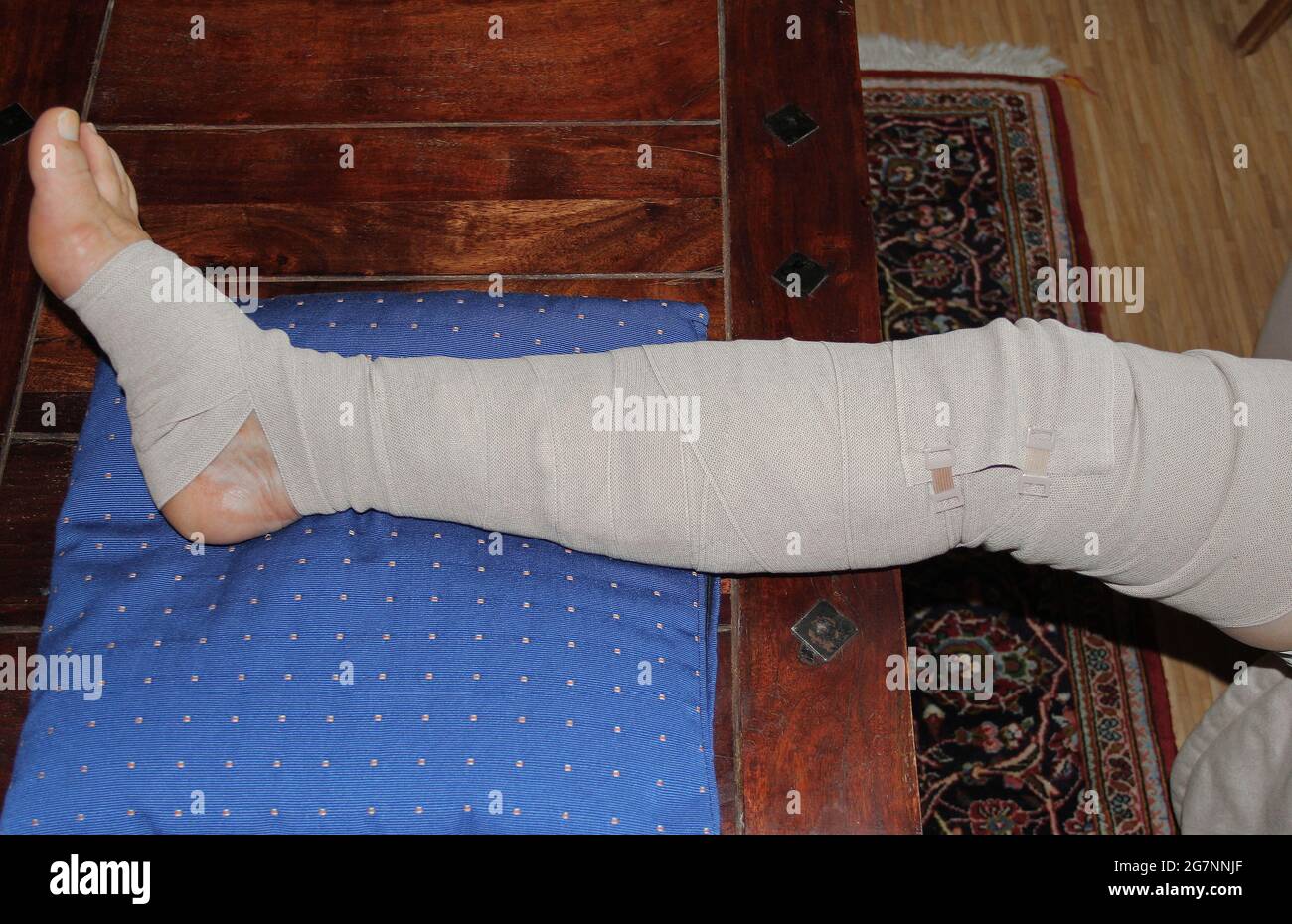 Vein operation hi-res stock photography and images - Alamy