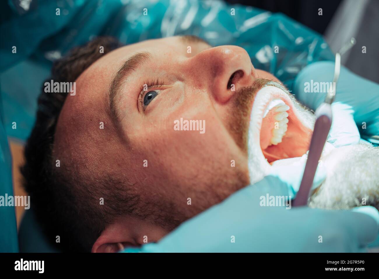 Caucasian male lying down with mouth wide open while male nurse ...