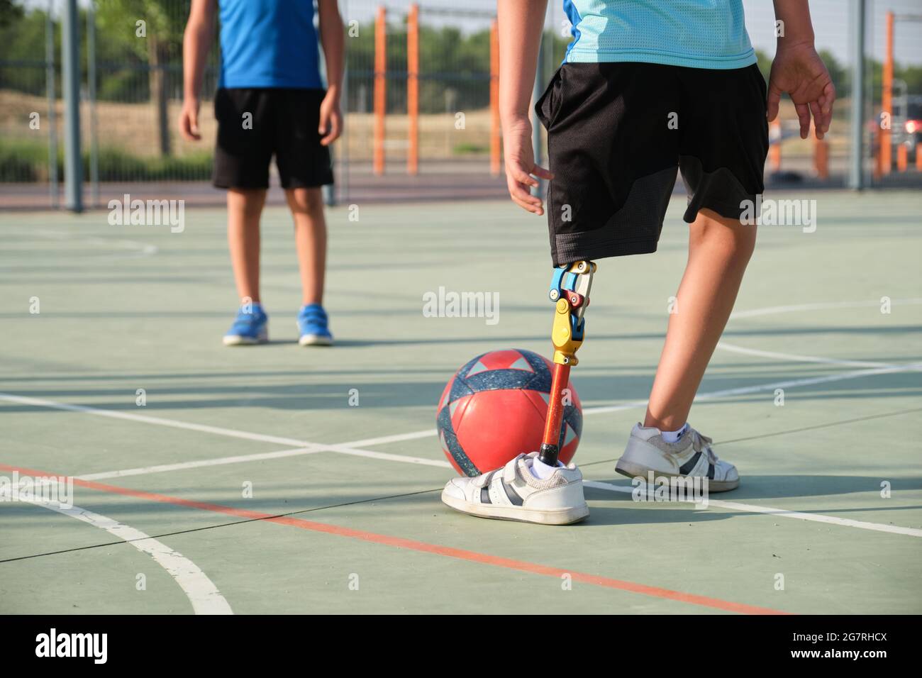 Unrecognizable children playing football, one of them has a leg ...