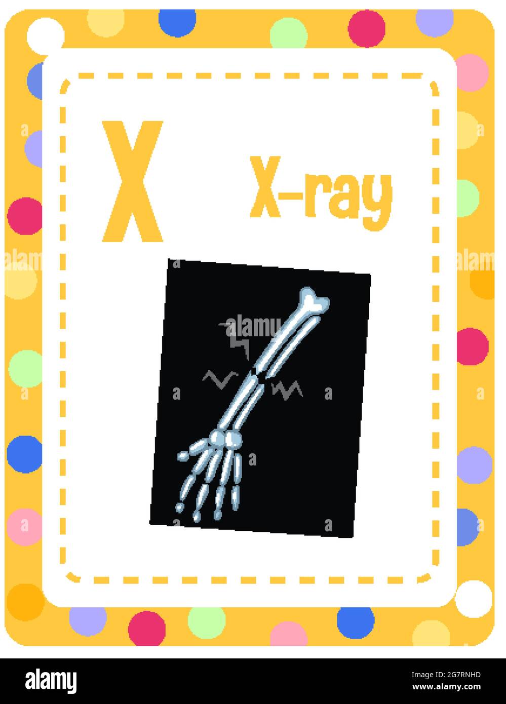 Alphabet flashcard with letter X for X-ray illustration Stock Vector ...