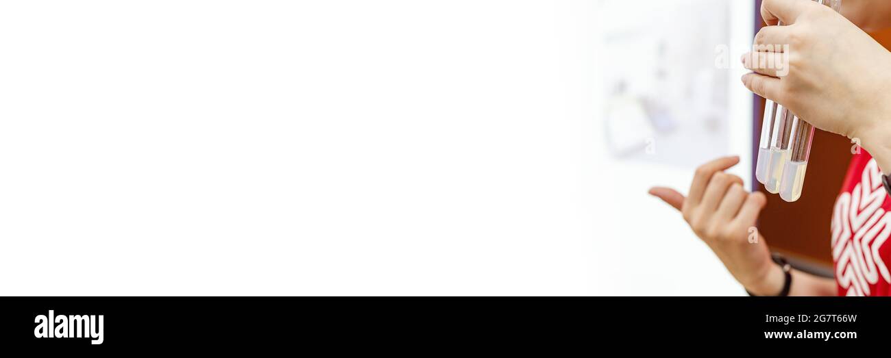 Glass test tubes in his hands and test tubes with blood samples for ...