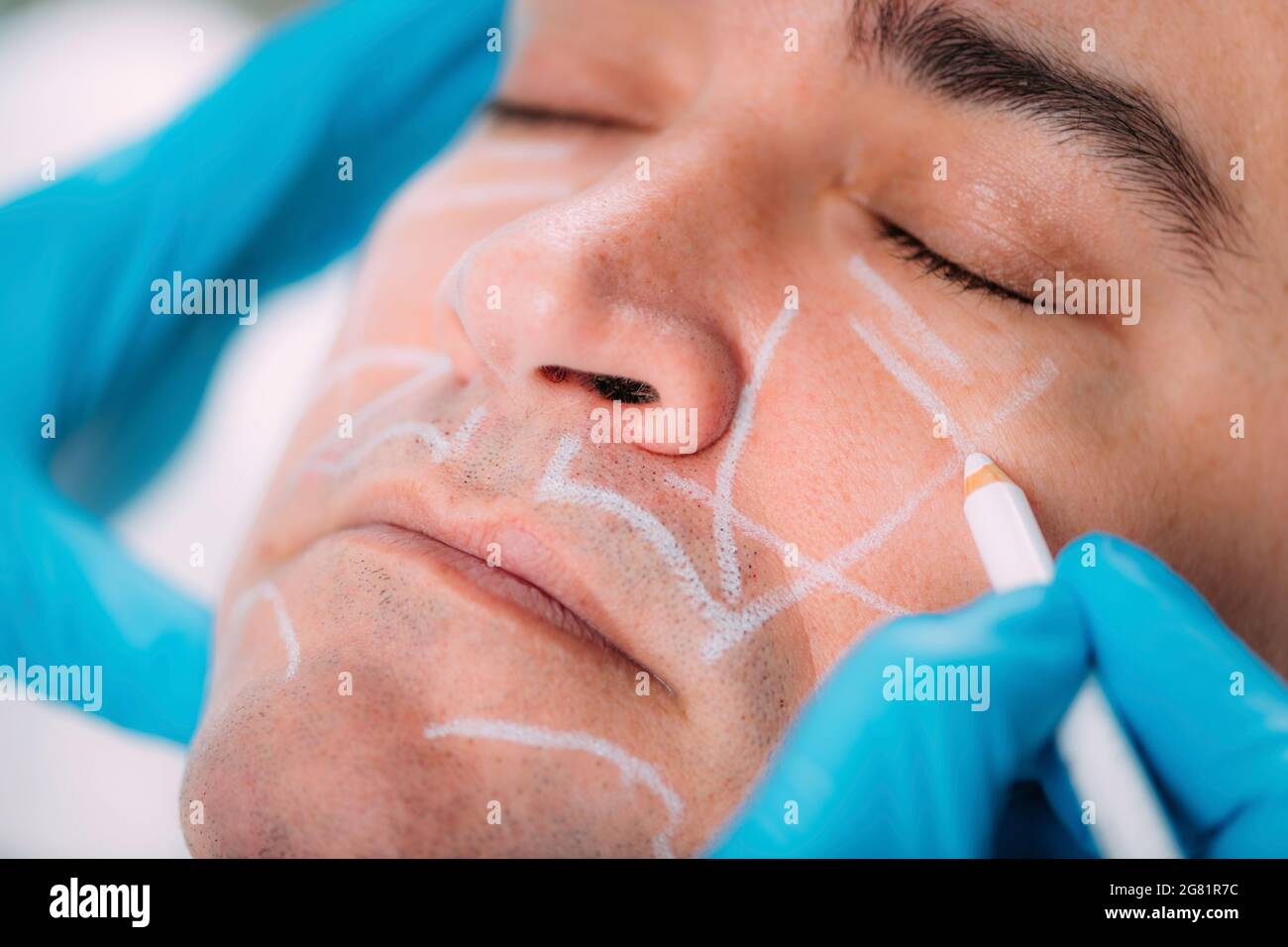 Male facial marking hi-res stock photography and images - Alamy