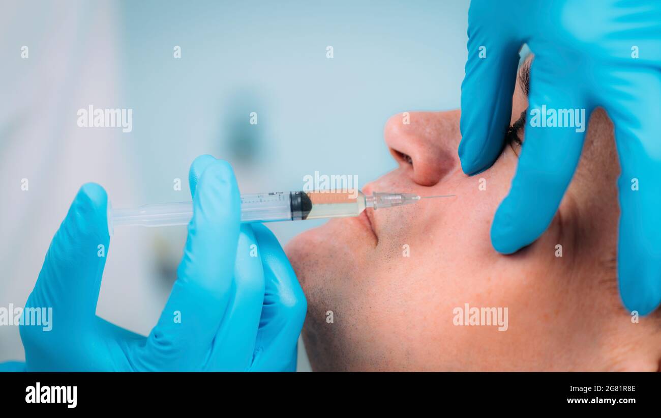 Close up filler injection hi-res stock photography and images - Alamy