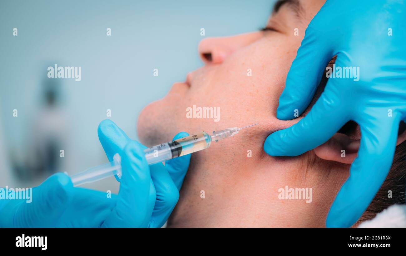 Dermal fillers jawline injection Stock Photo - Alamy