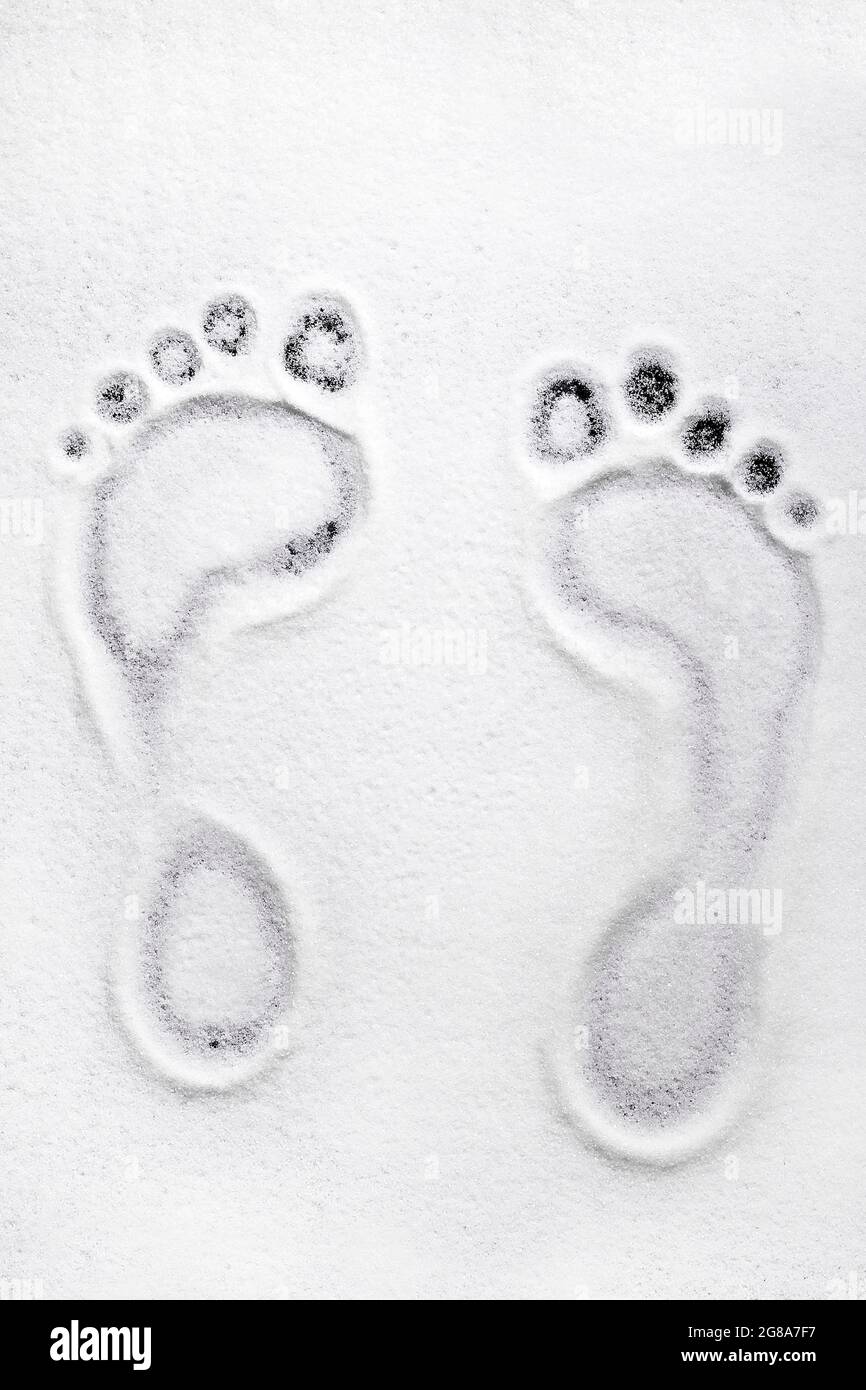 Diabetic foot infection hi-res stock photography and images - Alamy