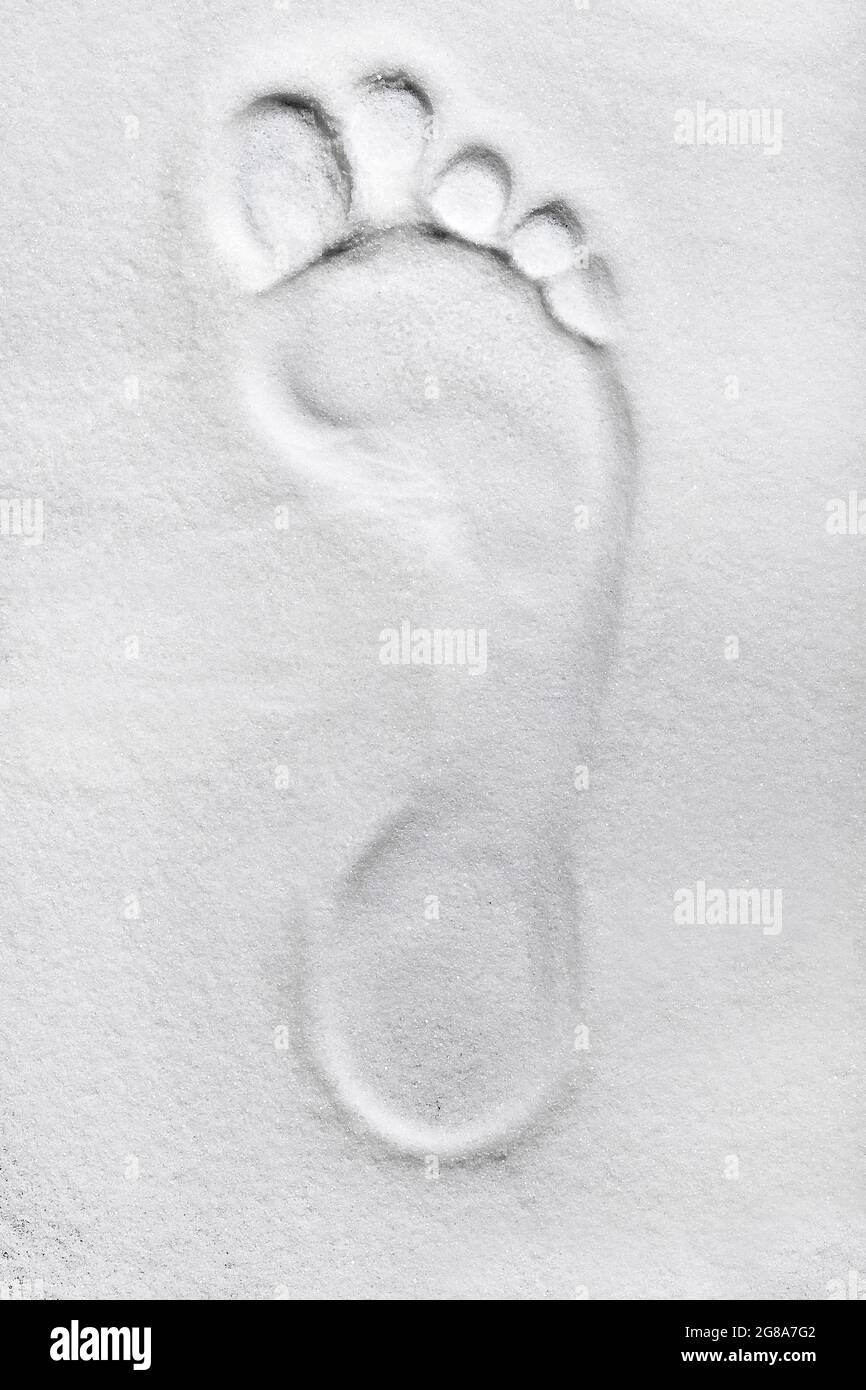 Diabetic foot infection hi-res stock photography and images - Alamy