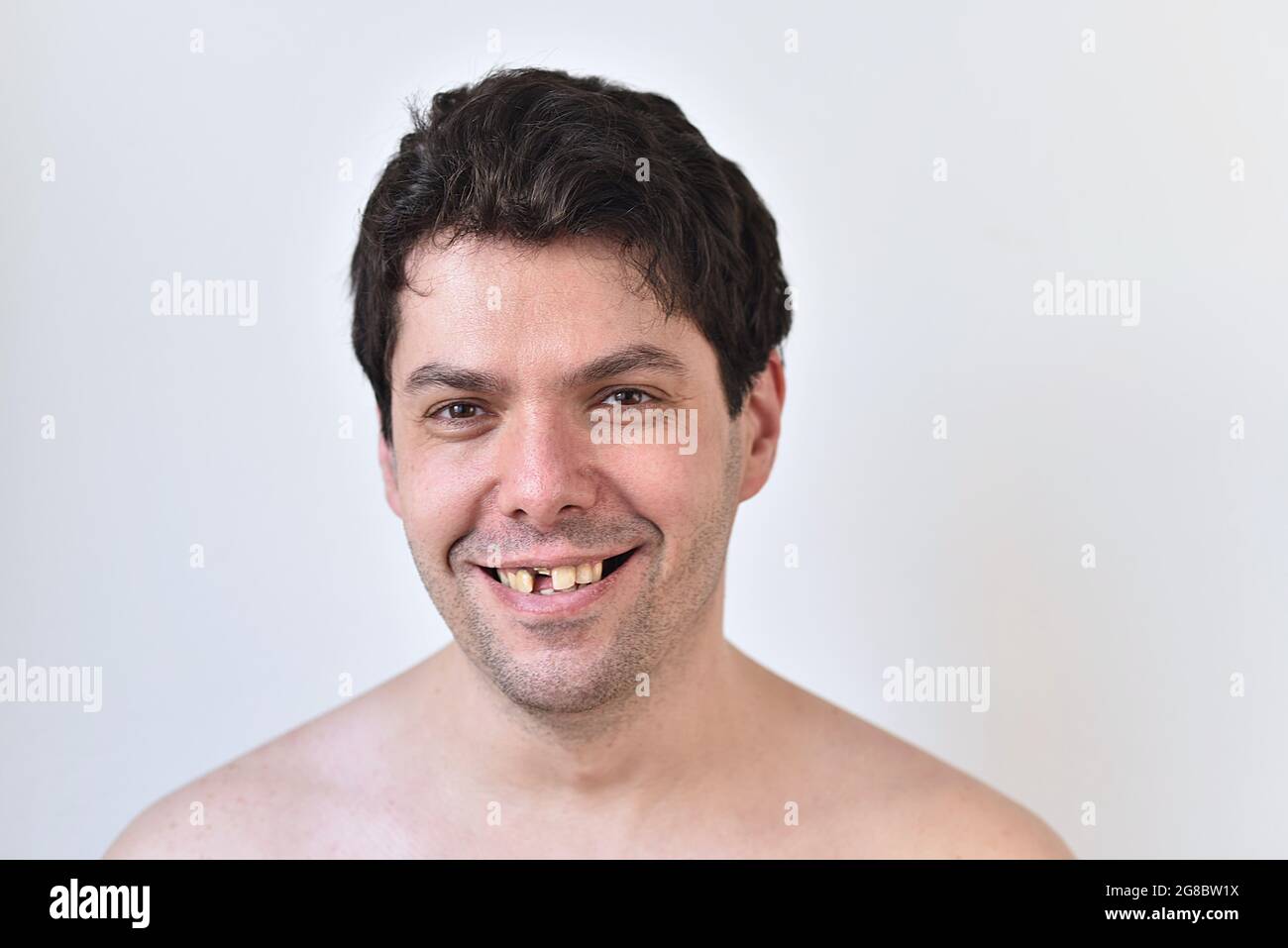 portrait of a man with broken teeth Stock Photo - Alamy