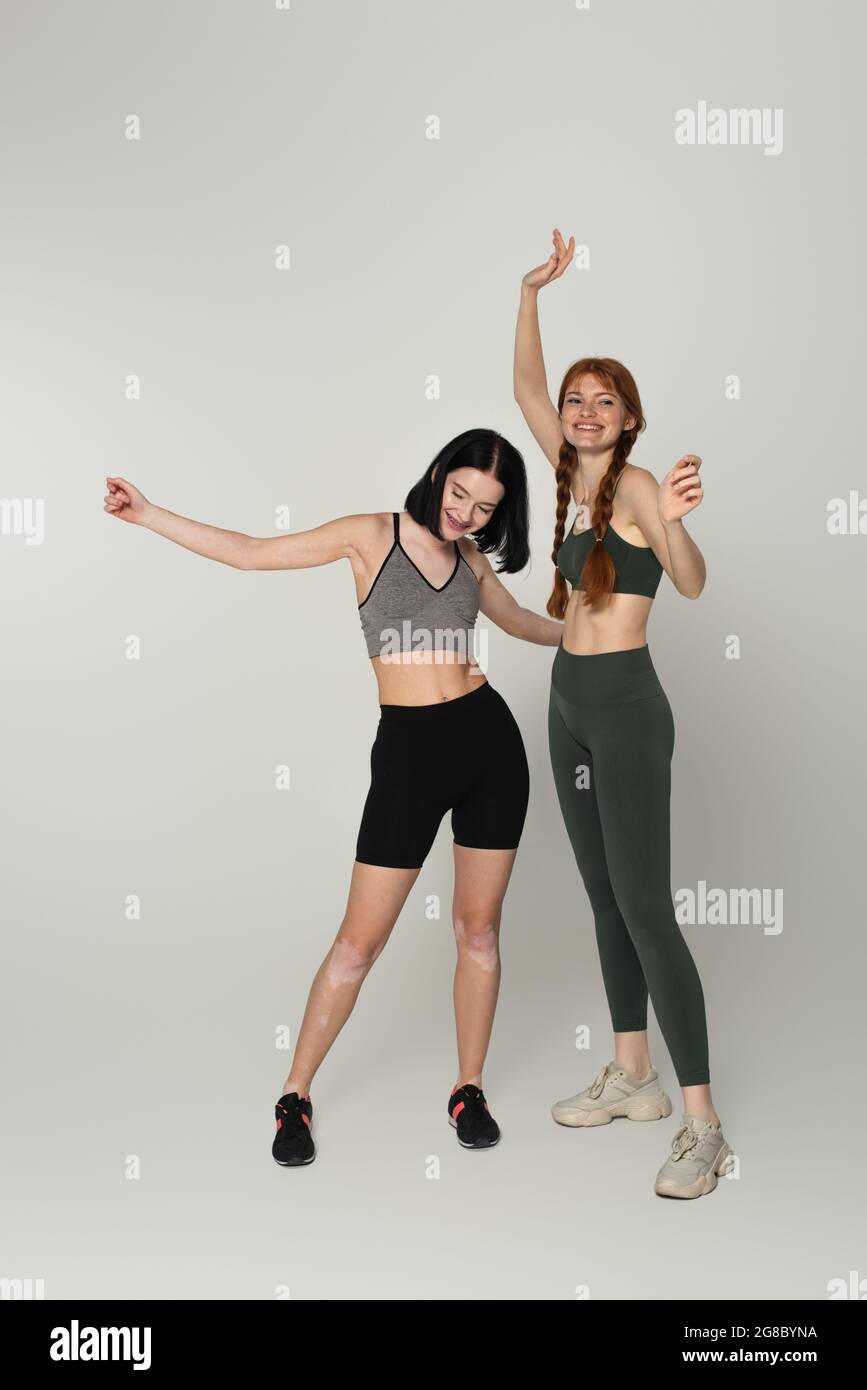 Cheerful young sportswomen with vitiligo and freckles dancing together ...