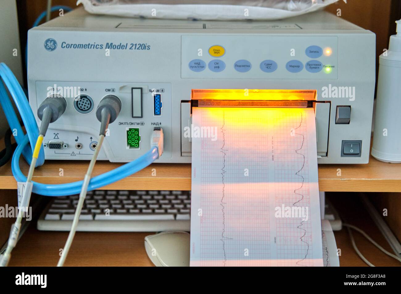 CTG device with monitoring of the state of health of the mother and ...