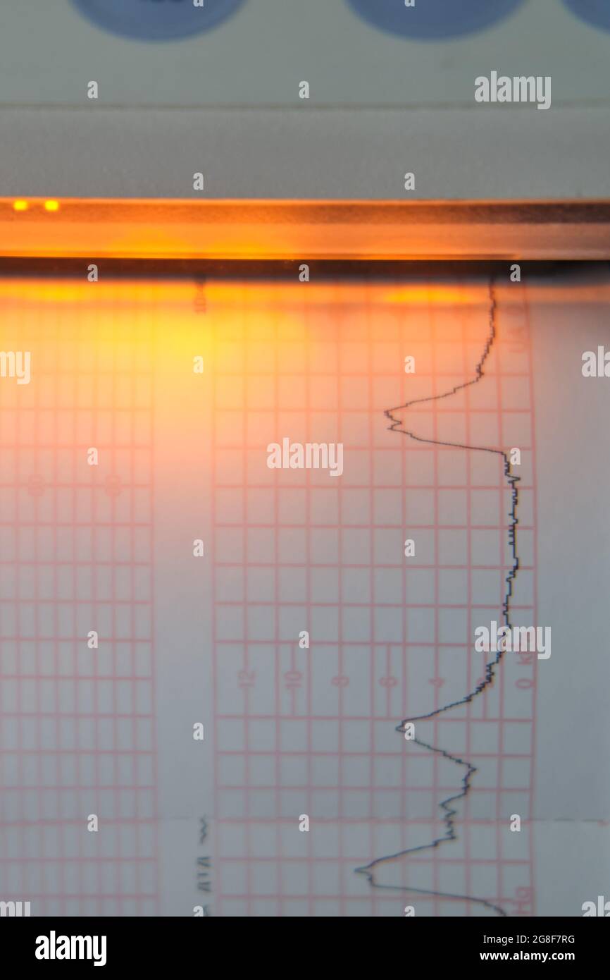 CTG device with monitoring of the state of health of the mother and ...