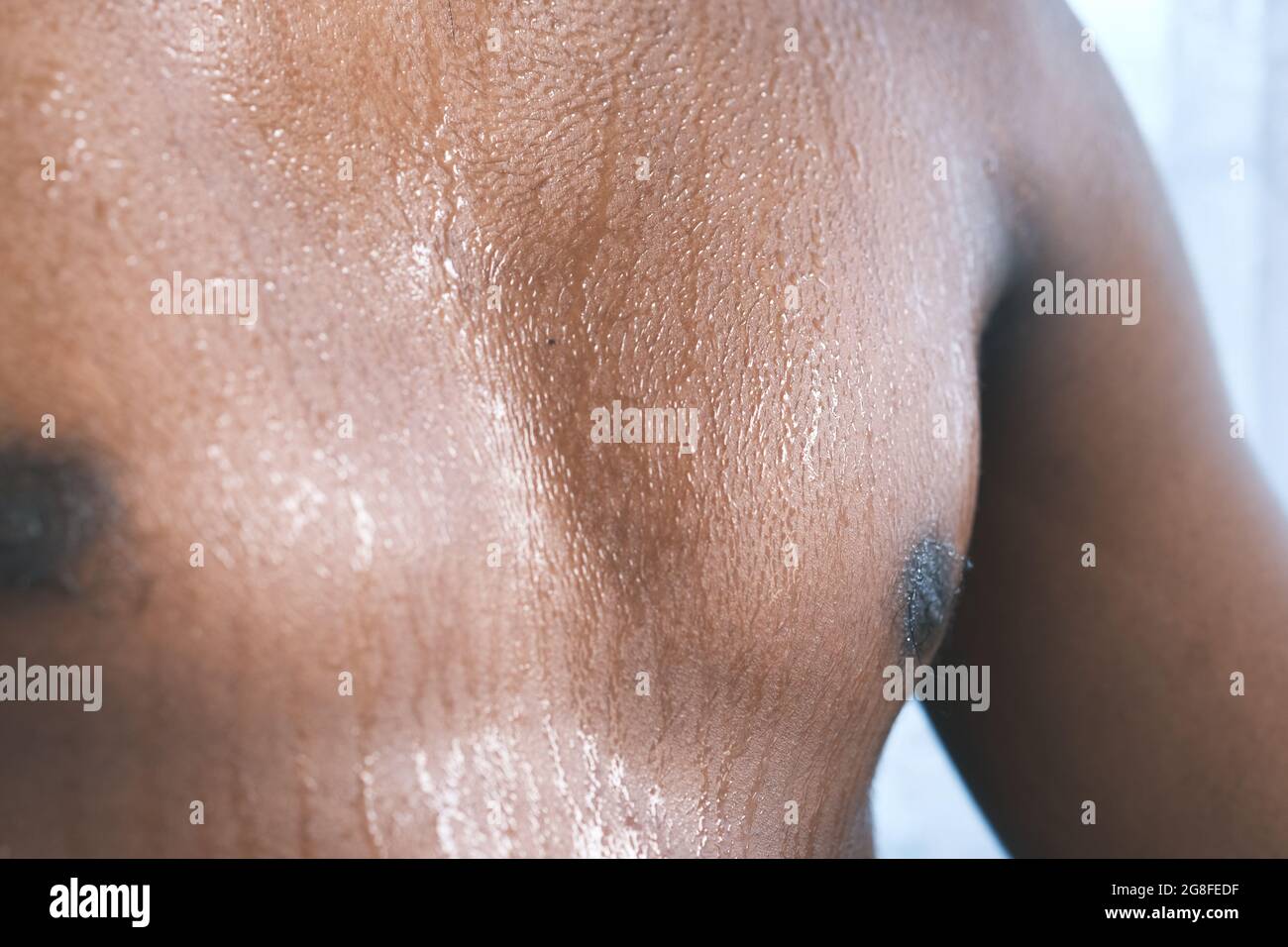 young man skin sweating in chests Stock Photo - Alamy