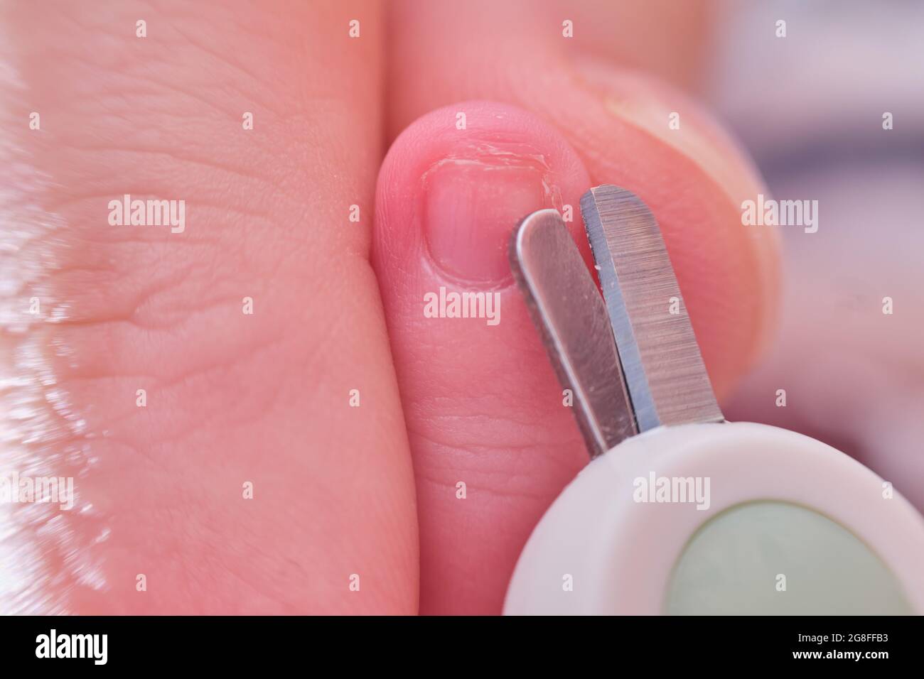 Cutting nails with special scissors on the fingers of a newborn baby ...