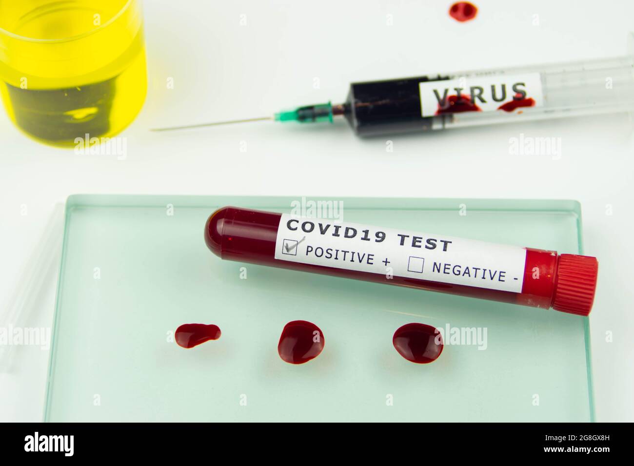 CORONA COVID 19 positive test tube sample blood test drops blood ...