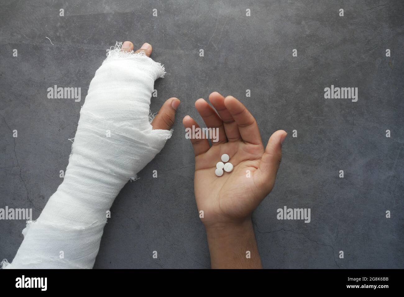 injured painful hand with bandage and medical pills on hand Stock Photo ...