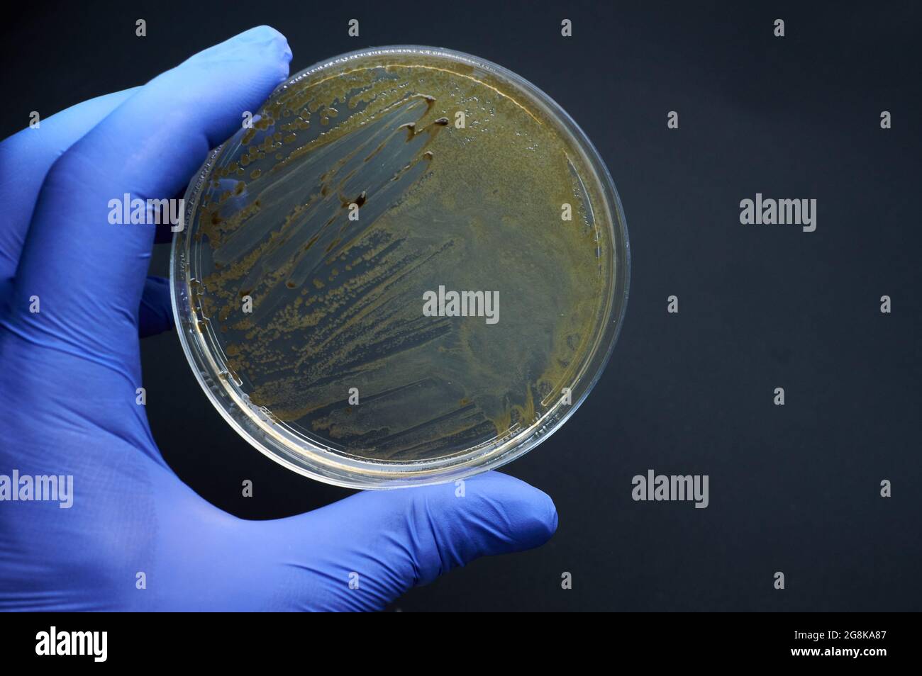 bacterial colonies of Salmonella on selective medium plate on black ...