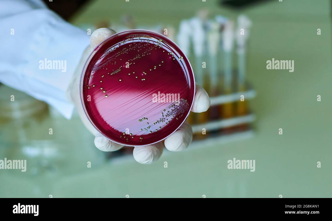 bacterial colonies of E coli on medium plate hold in hand of researcher ...