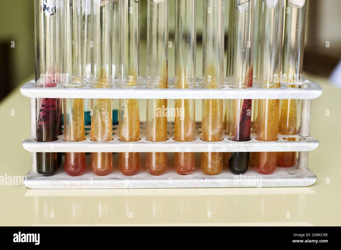 Test tube in holder with Kligler agar medium suspected to salmonella ...