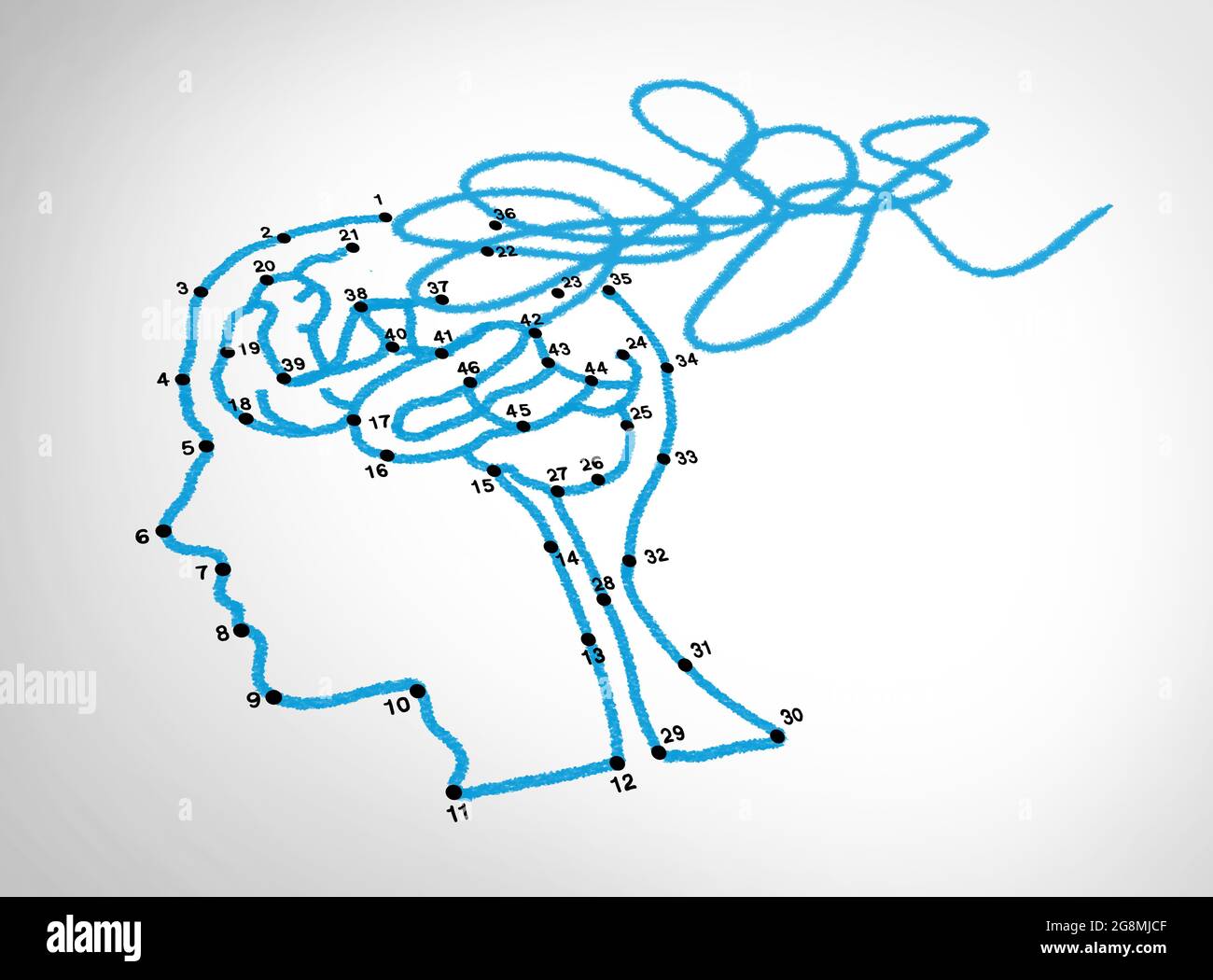 Alzheimer's disease brain hi-res stock photography and images - Alamy