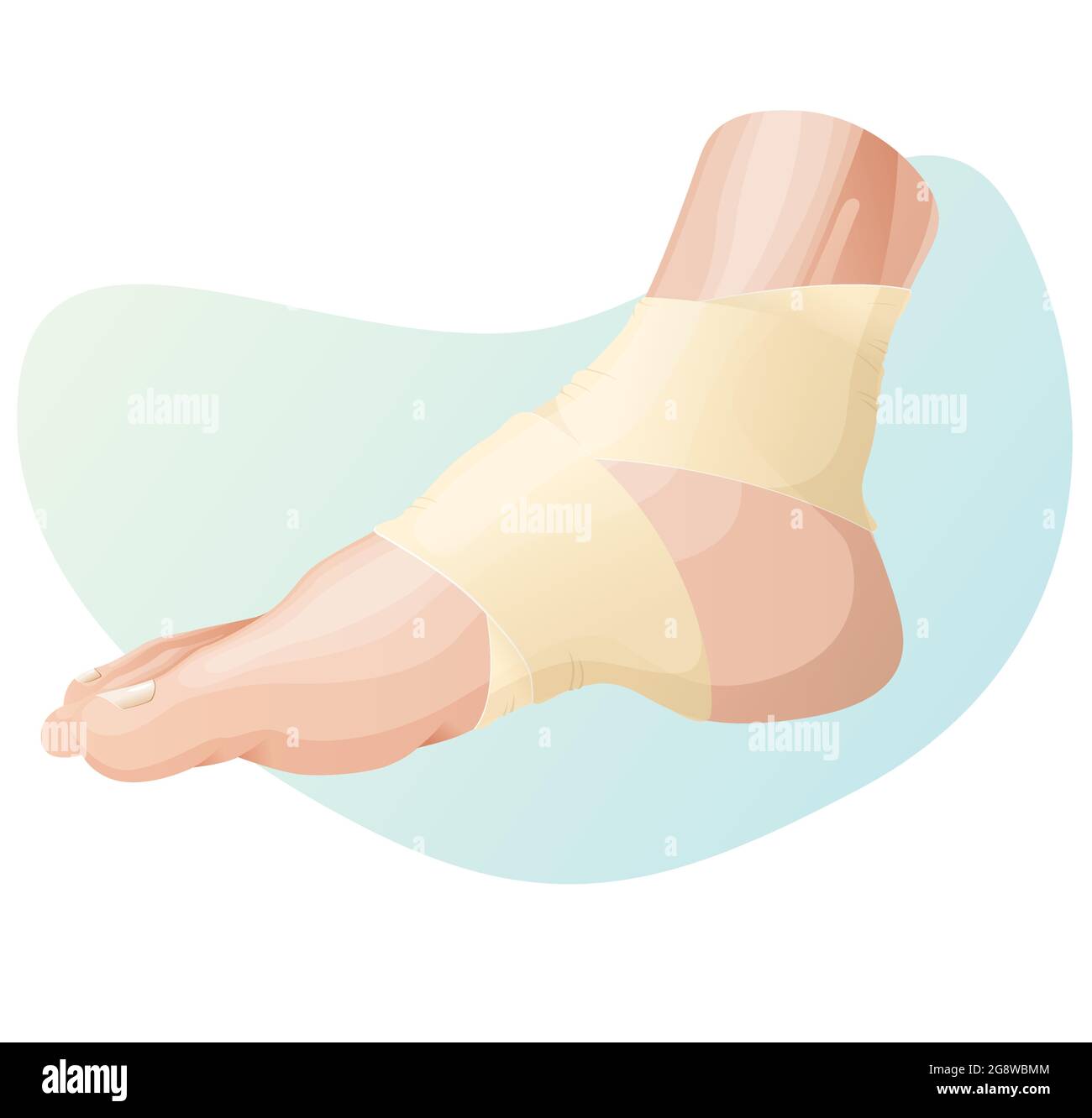 Illustration ankle bandage hi-res stock photography and images - Alamy