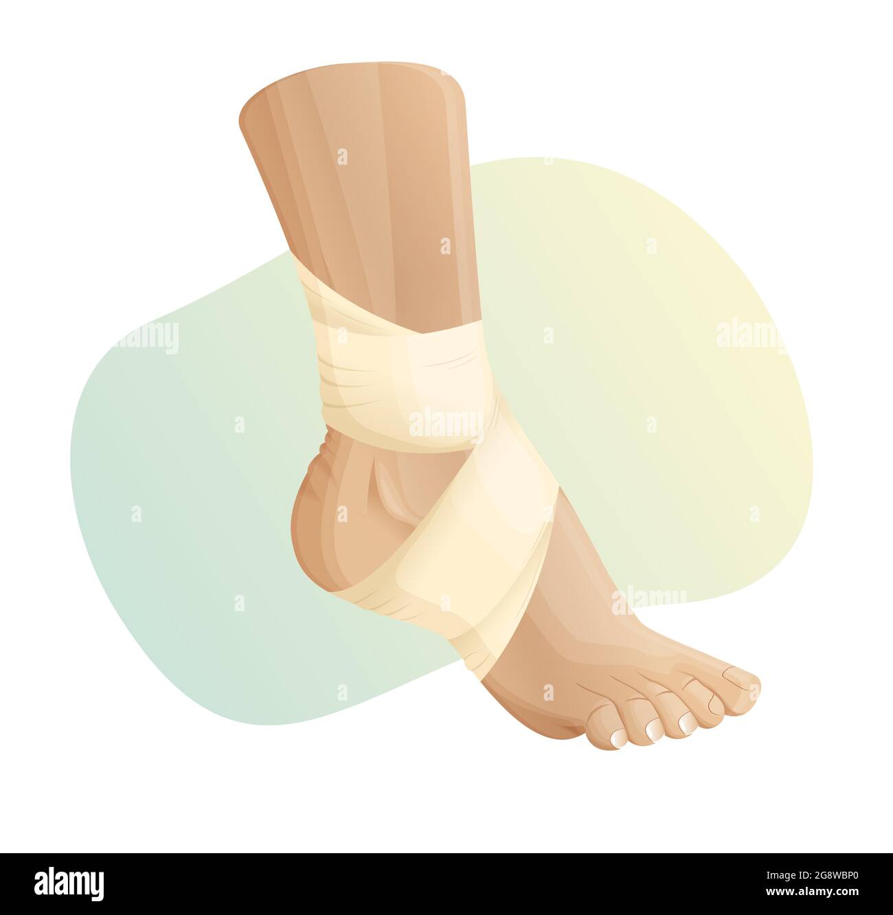 Elastic bandage for Ankle Sprain - Illustration as EPS 10 File Stock ...