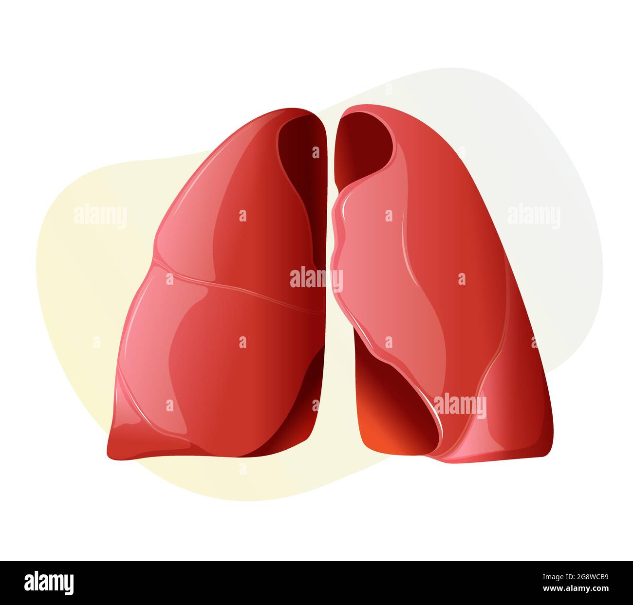 Edema vector vectors hi-res stock photography and images - Alamy