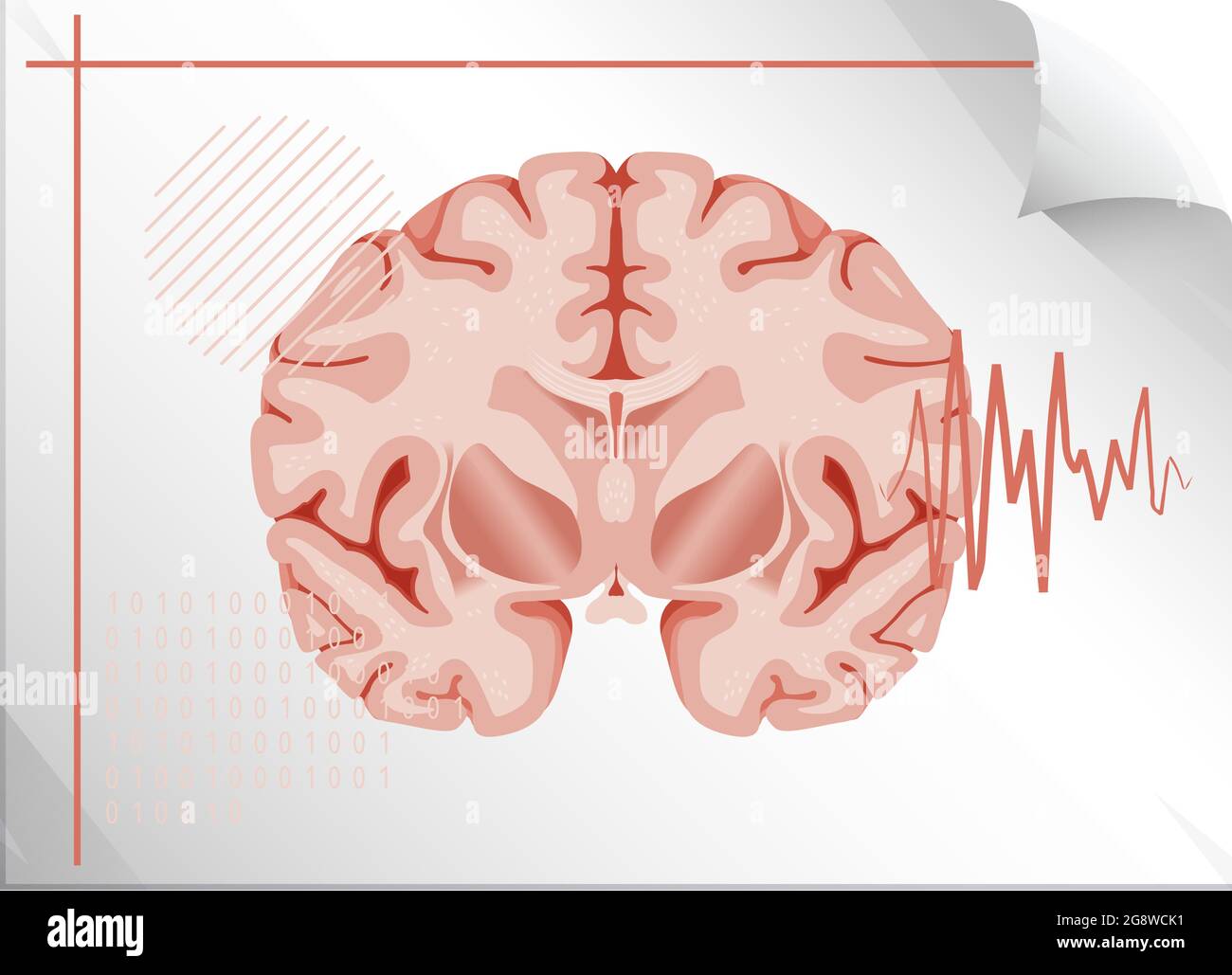 Brain transverse section High Resolution Stock Photography and Images ...