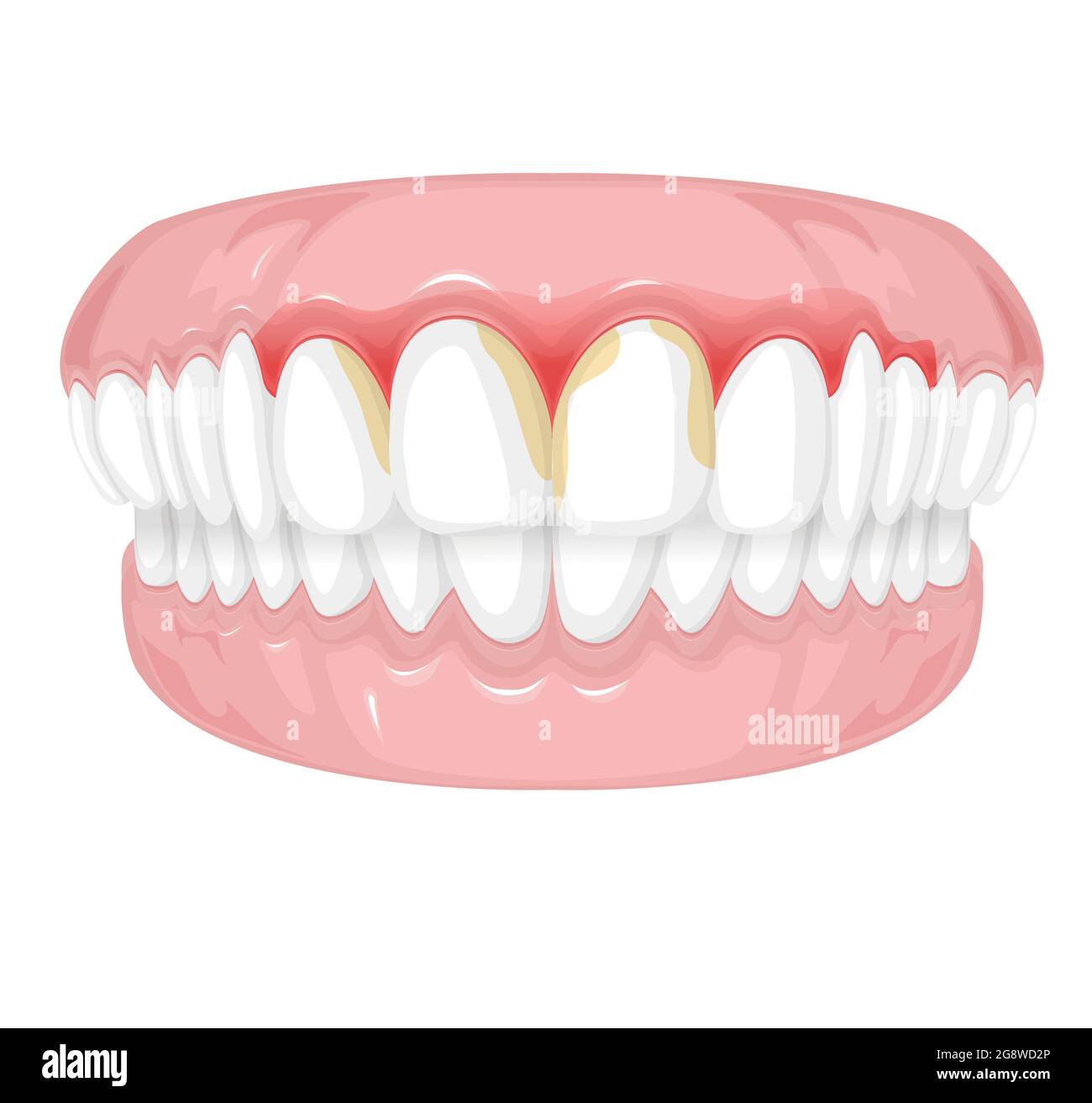 Tooth and gums icon vector vectors hi-res stock photography and images ...