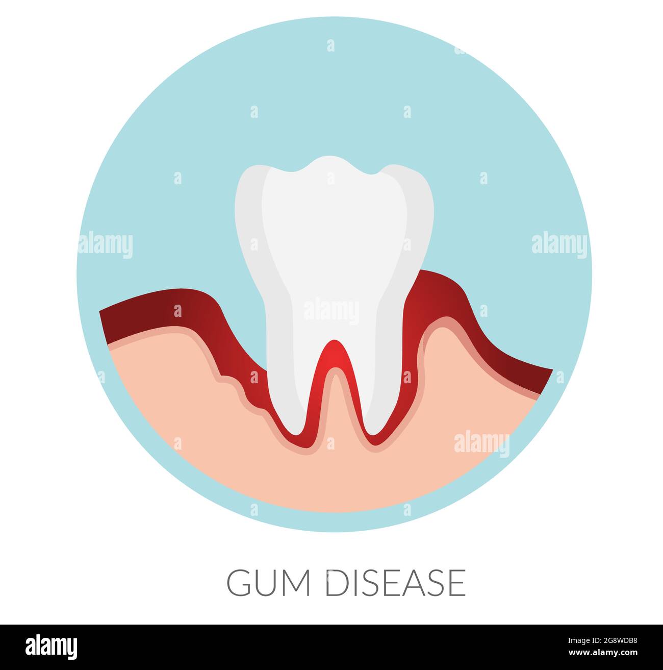 Abscess vector vectors Stock Vector Images - Alamy