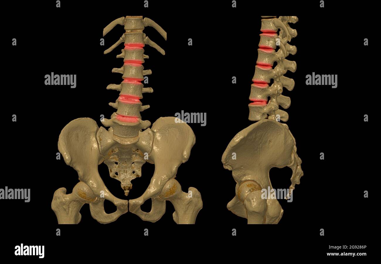 CT Lumbar spine or L-S spine 3D rendering image AP and Lateral view ...