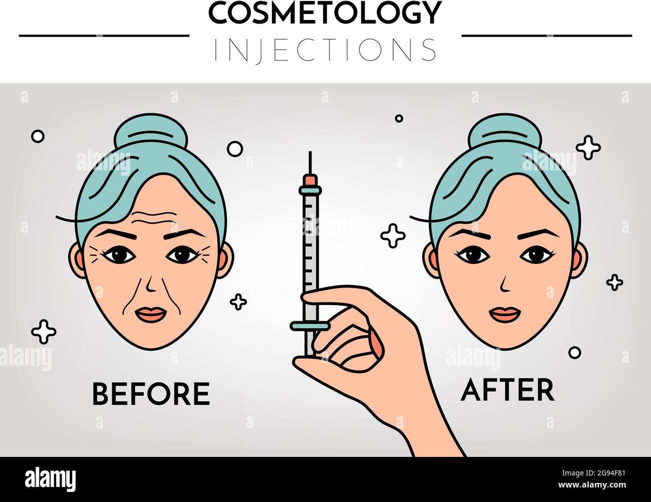 Cosmetic injections. Infographics before and after. Vector flat ...