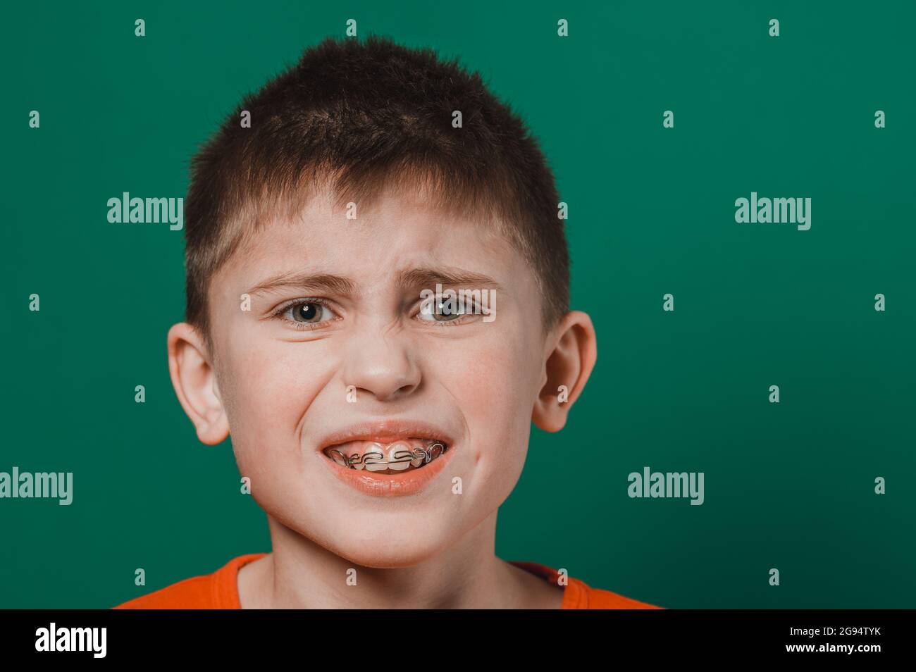 A boy of Caucasian nationality demonstrates a plate for straightening ...