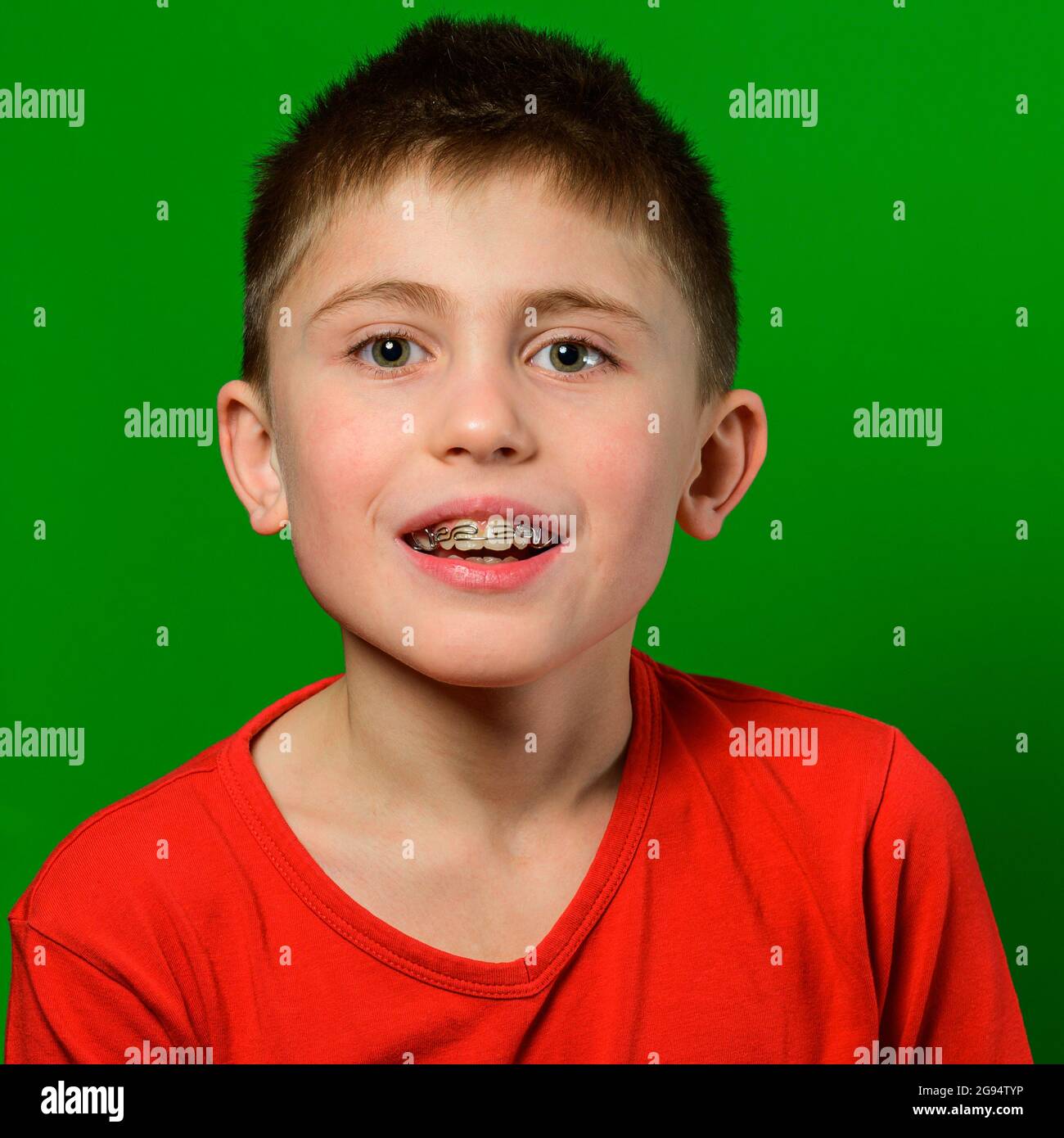 A boy of Caucasian nationality demonstrates a plate for straightening ...