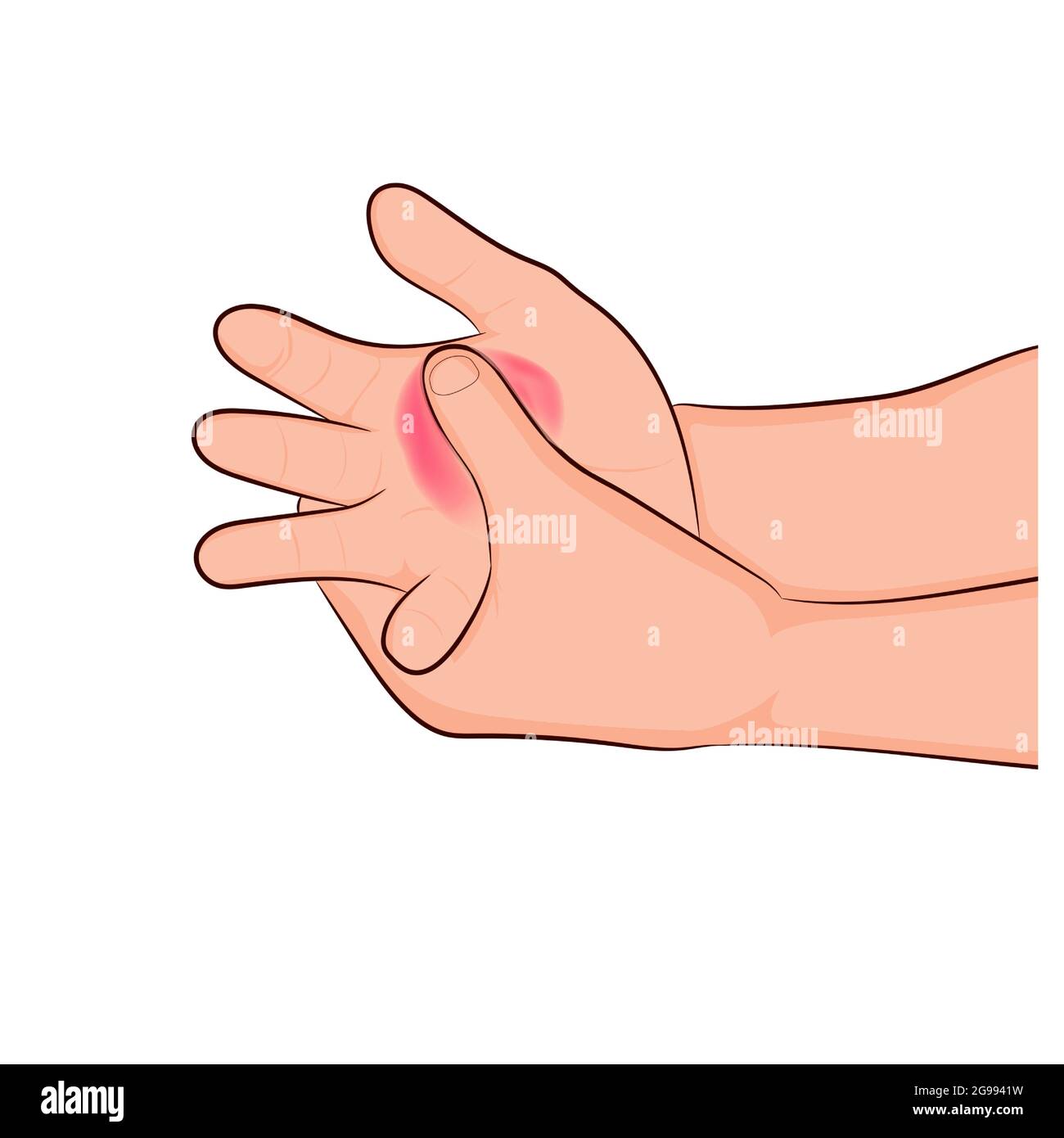 image graphics vector outline Wrist pain is often caused by sprains or ...