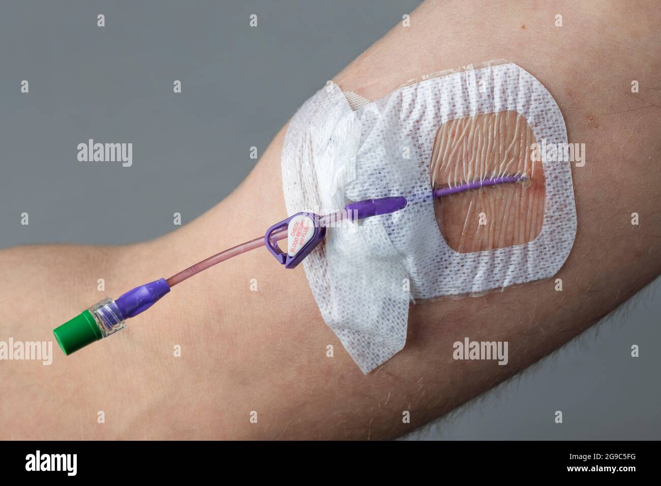 Picc line hi-res stock photography and images - Alamy