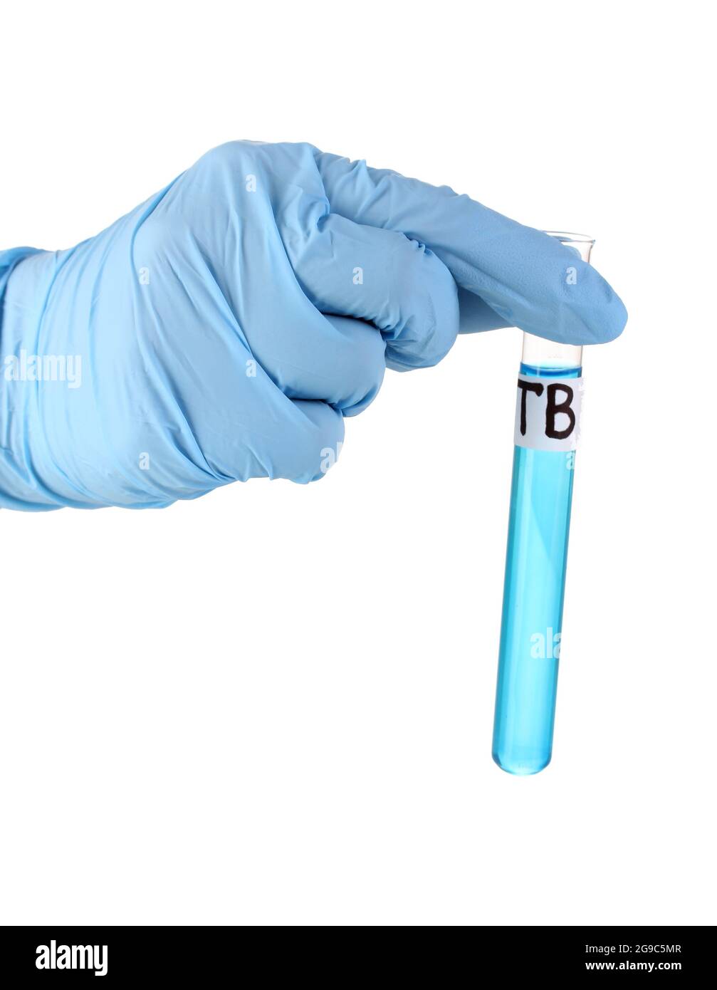 Test tube labeled Tuberculosis(TB) isolated on white Stock Photo - Alamy