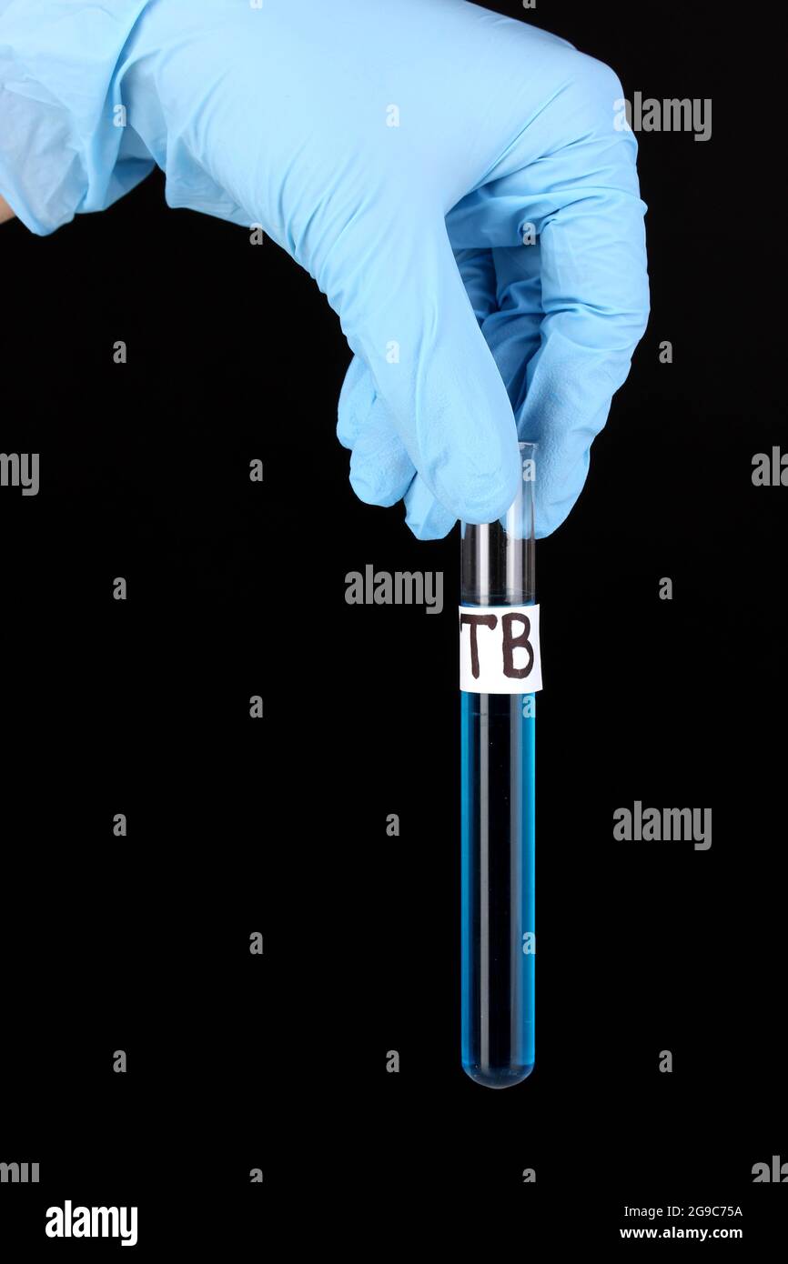 Test tube labeled Tuberculosis(TB) in hand isolated on black Stock ...