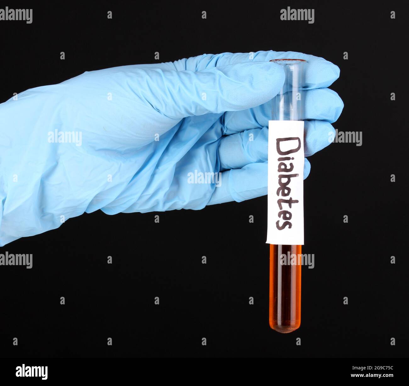 Test tube labeled Diabetes in hand isolated on black Stock Photo - Alamy