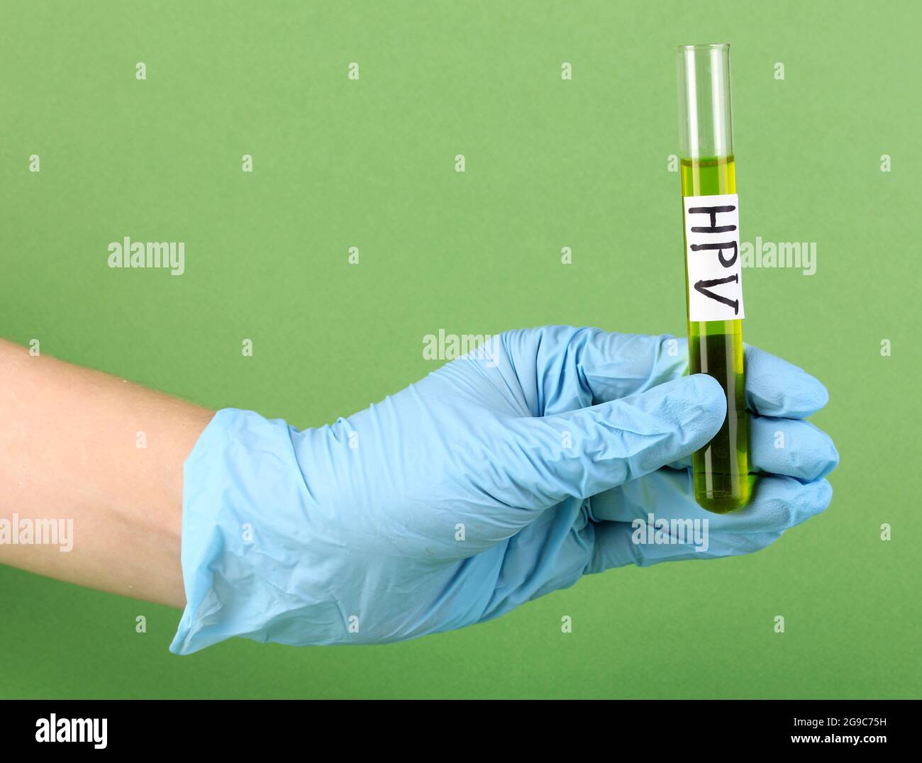 Test tube labeled Human Stock Photo - Alamy