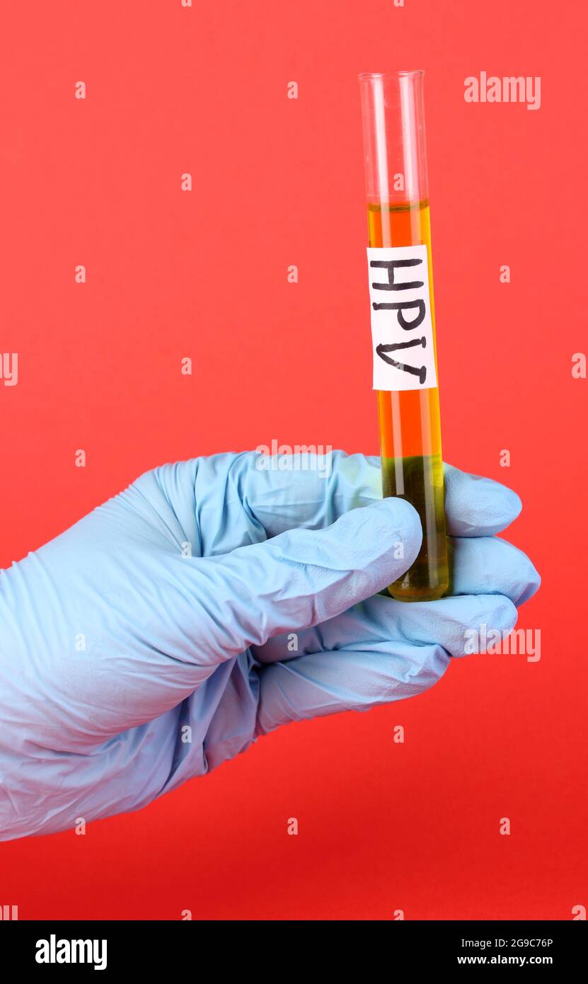 Test tube labeled Human Stock Photo - Alamy