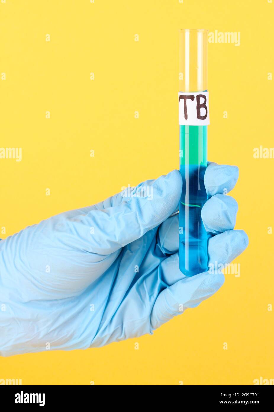 Test tube labeled Tuberculosis(TB) in hand on yellow background Stock ...
